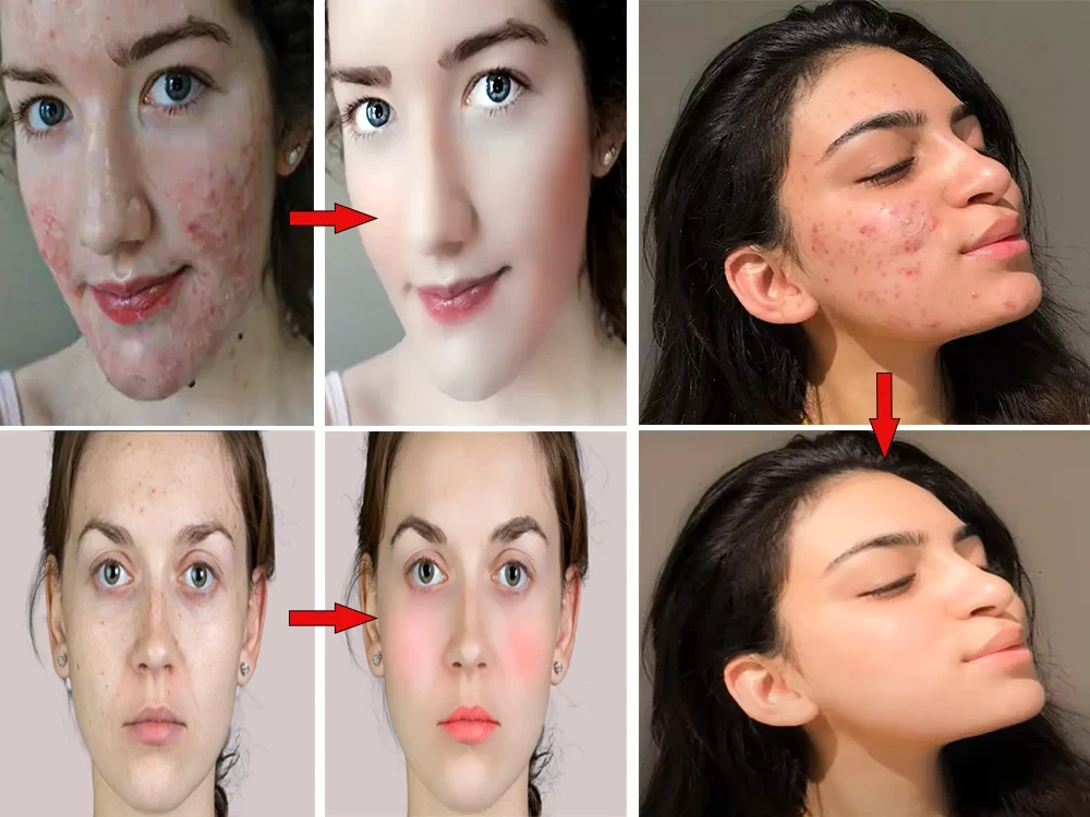 Photoshop Image Editing, Ecommerce Product Editing & Retouching ...