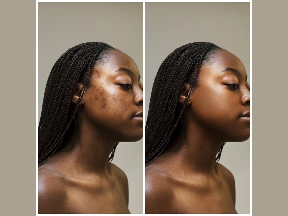 Photo Retouch/Background Remover/Professional Photoshop | Upwork