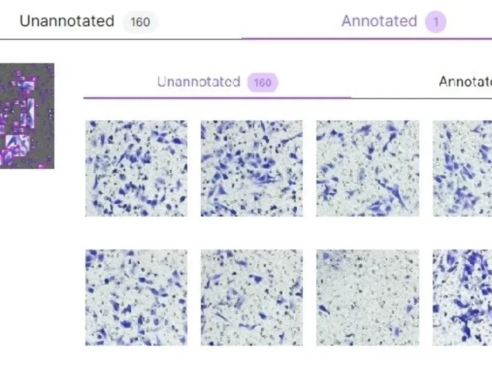 Annotated Image Data For Object Detection Ai Ml Dl And Nlp Upwork