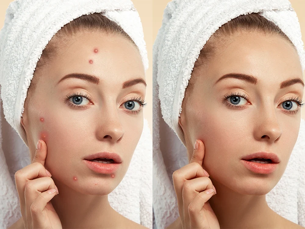 High end photo retouching, skin retouching and photo editing services | Upwork