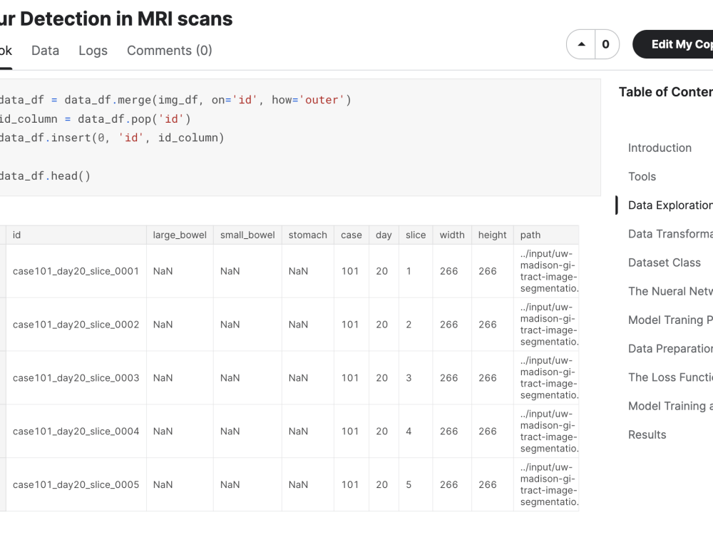 A means to how you can automatically detect tumor from an MRI Image ...