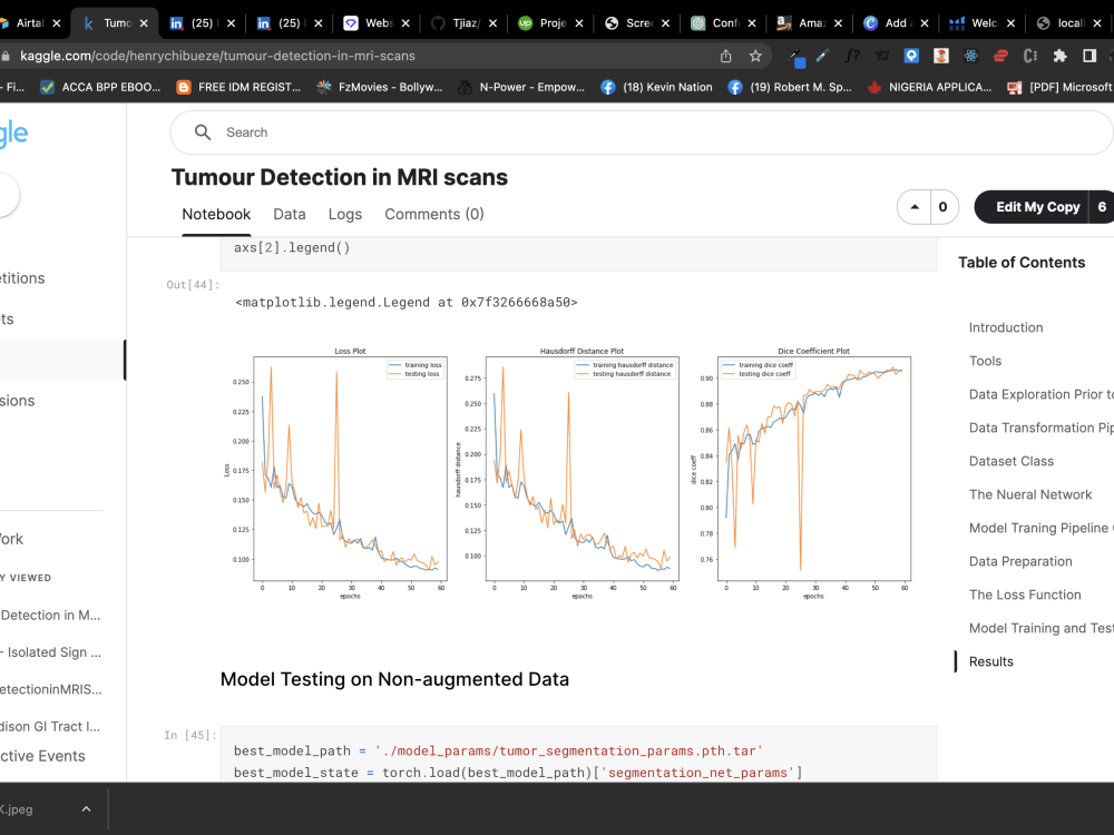 A means to how you can automatically detect tumor from an MRI Image ...