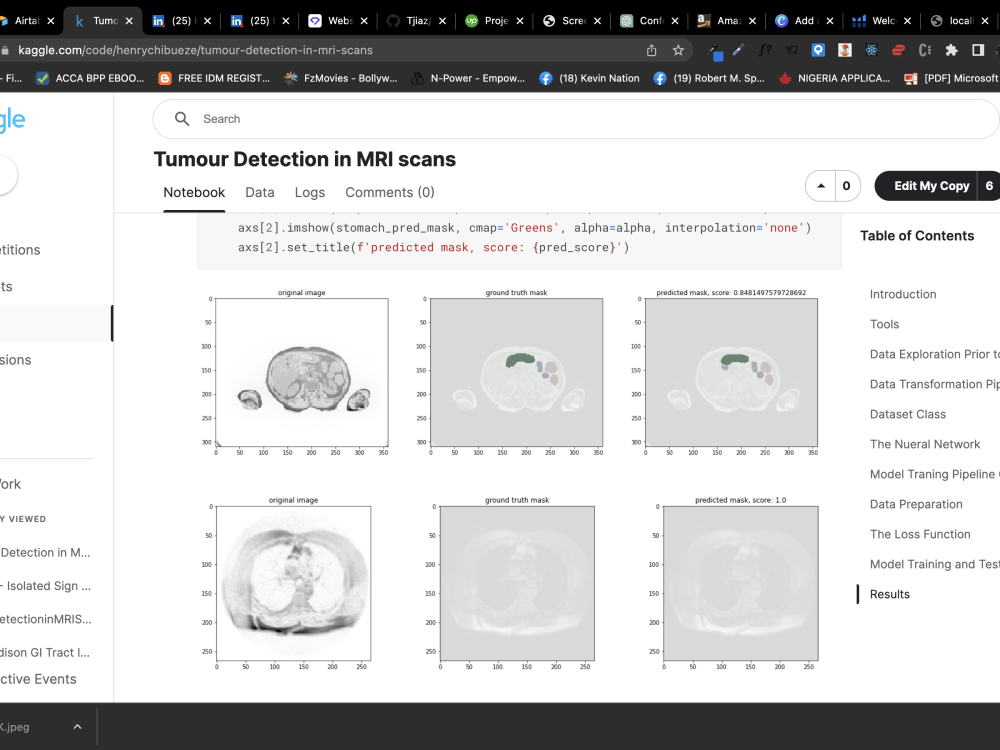 A means to how you can automatically detect tumor from an MRI Image ...