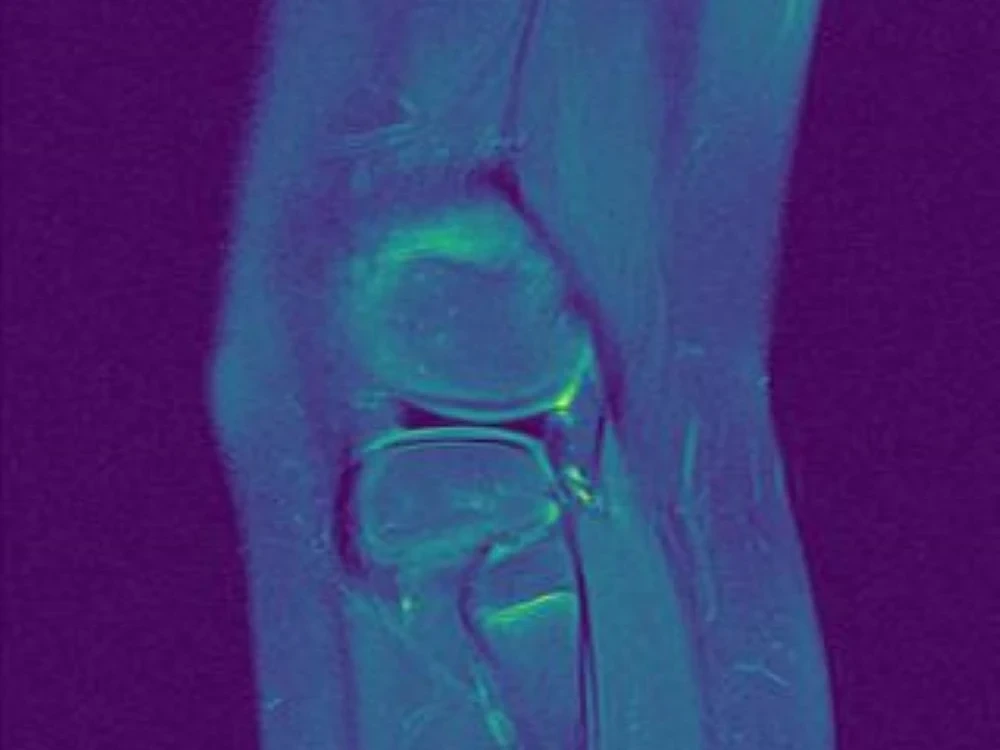 Feature Extraction MRI images deep learning | Upwork