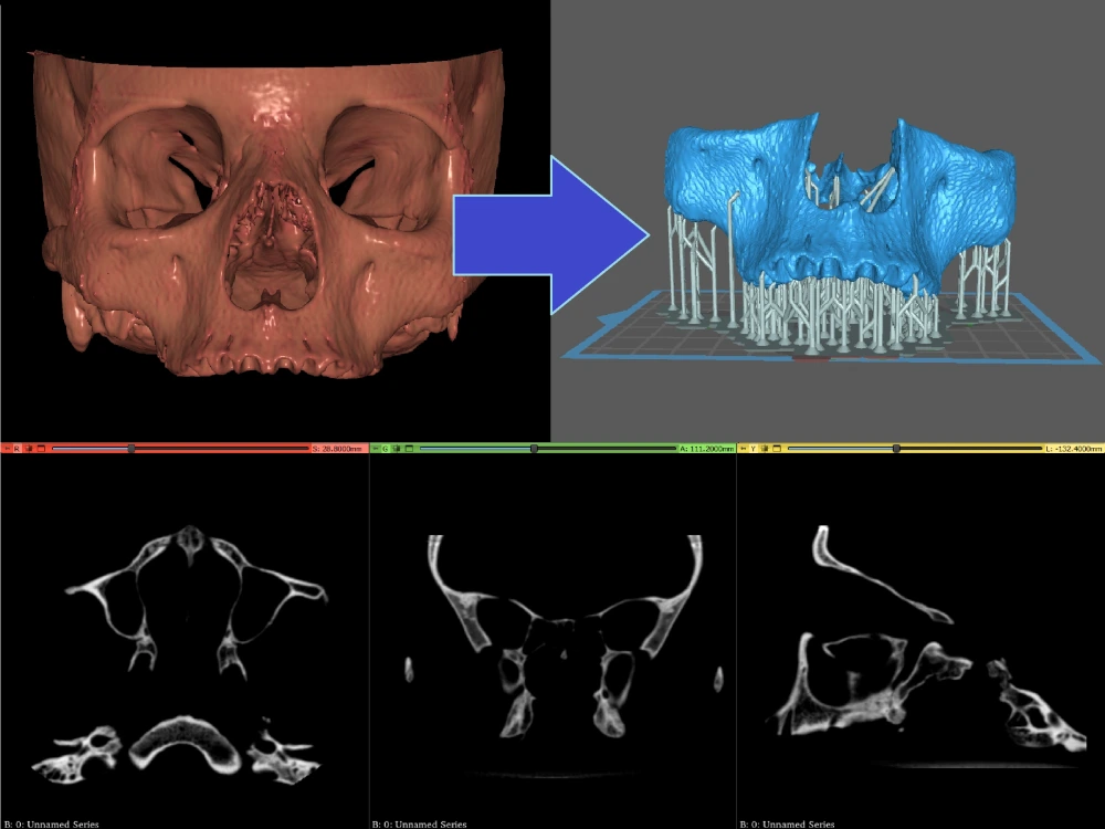 CT or CBCT scan converted into a 3D Printable model (CT to STL) | Upwork