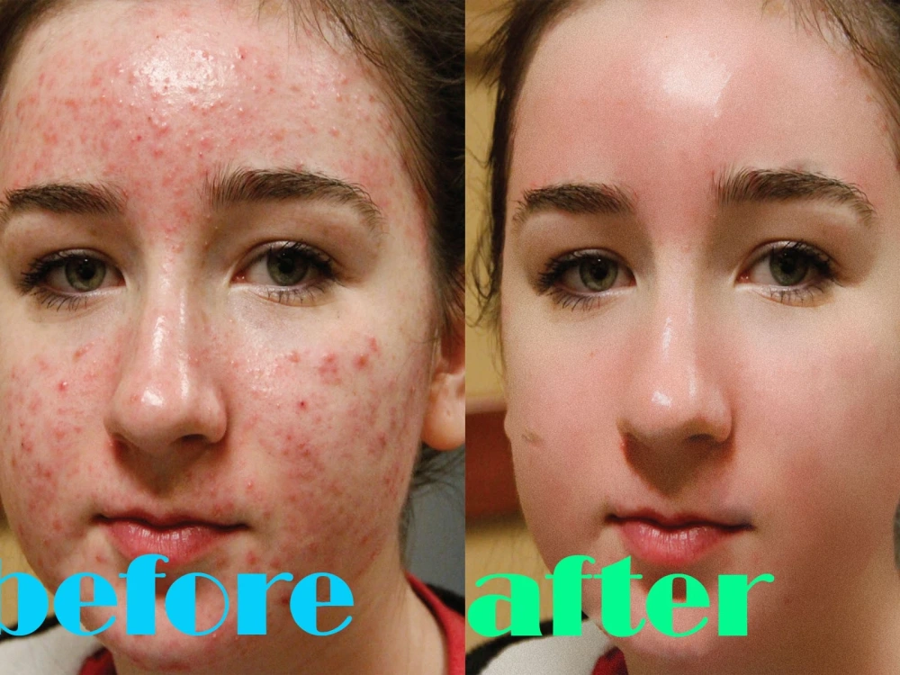 An awesome editing that make you have no acne,wrinkles,etc | Upwork