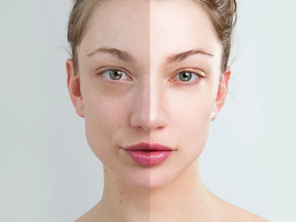 Professional skin retouching and enhancement in photoshop | Upwork