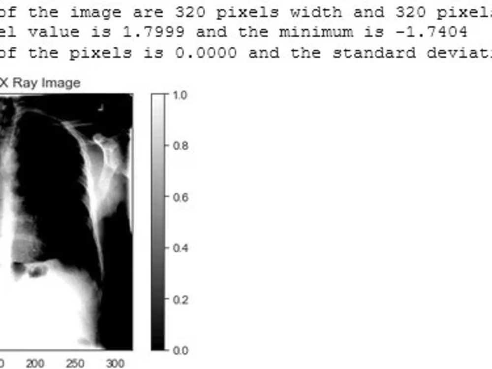 A Complete Computer Vision Project On Object Detection And Img