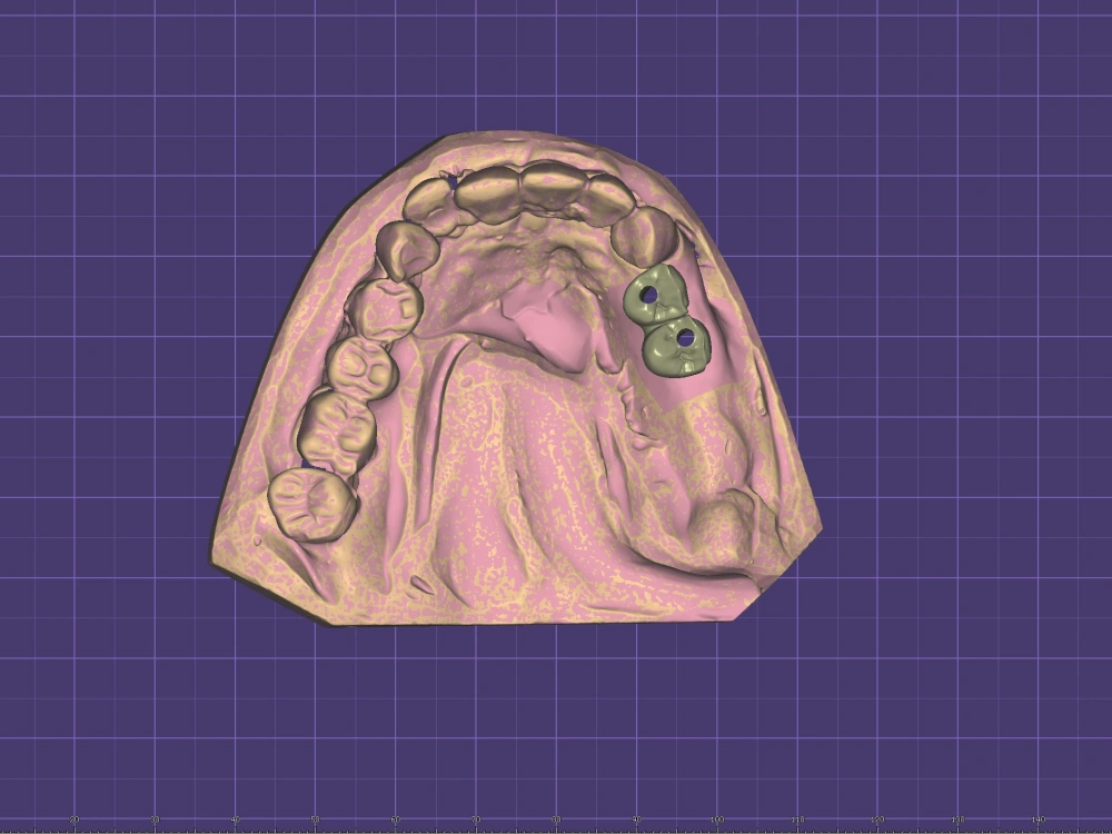 The best dental design and all dental work using all design software ...