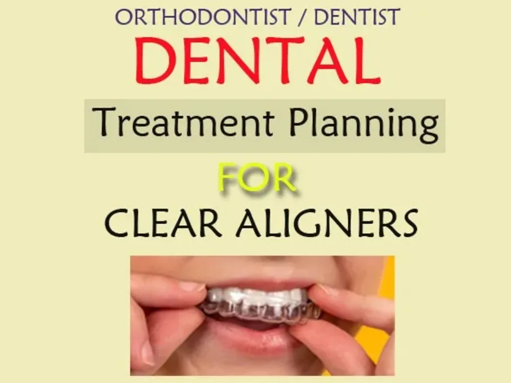 Treatment planning for orthodontic clear aligners Invisalign | Upwork