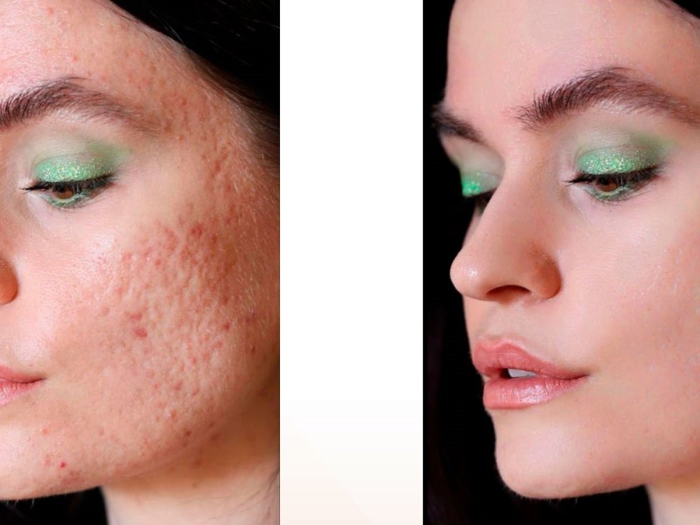 Subtle skin smoothing and blemish removal to advanced color correction ...
