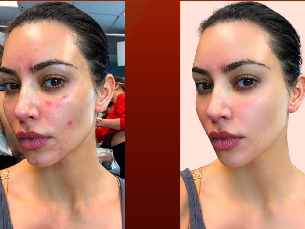 Subtle skin smoothing and blemish removal to advanced color correction ...