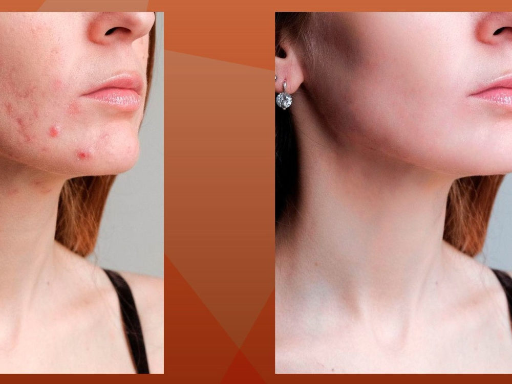 Subtle skin smoothing and blemish removal to advanced color correction ...