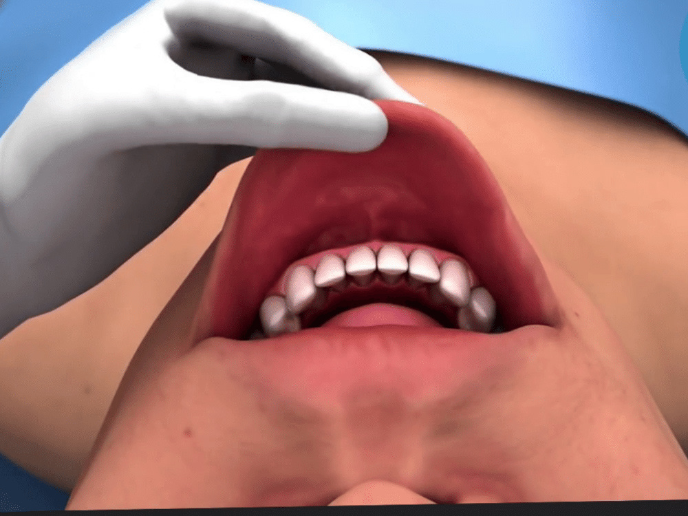 An Engaging 3D Dental Animation for Educational Purposes | Upwork