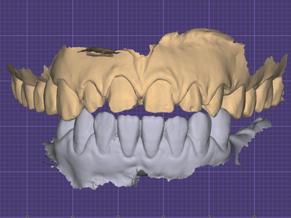 A Exocad dental digital mockup design | Upwork