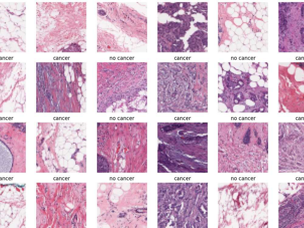 Breast Cancer Classification using Deep Learning Models | Upwork
