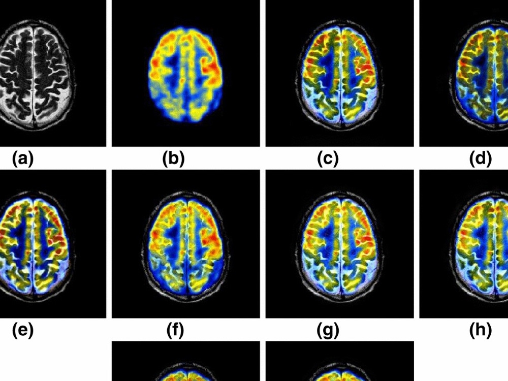 A Disease Detection Classification Segmentation Model For Medical