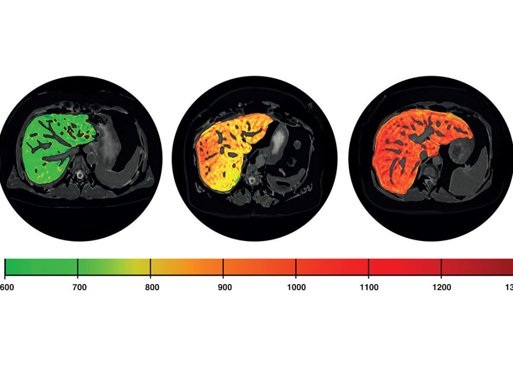 A Disease Detection/Classification/Segmentation model for Medical Images | Upwork