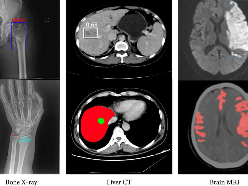 A Disease Detection/Classification/Segmentation model for Medical Images | Upwork