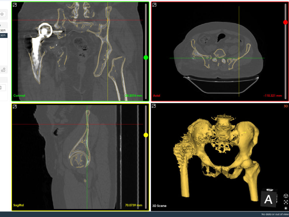 Medical Segmentation software with Modular approach | Upwork