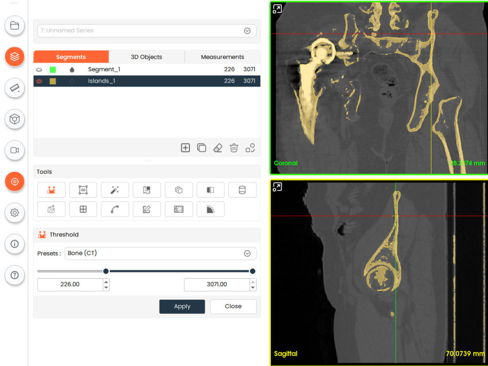 Medical Segmentation software with Modular approach | Upwork