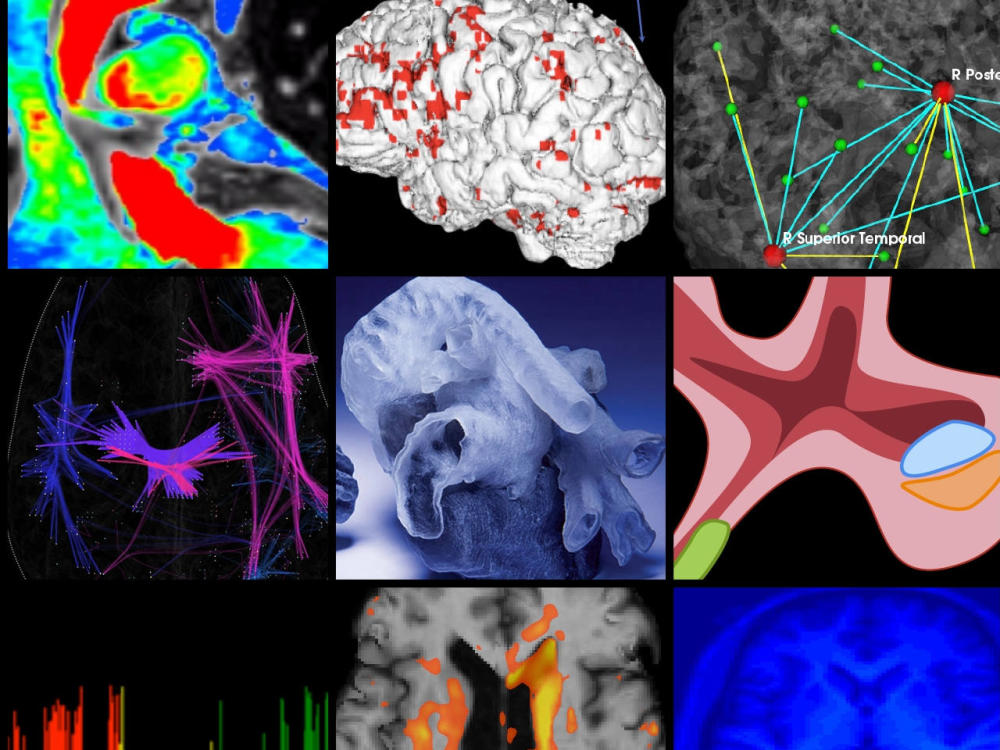 A Disease Detection/Classification/Segmentation model for Medical Images | Upwork