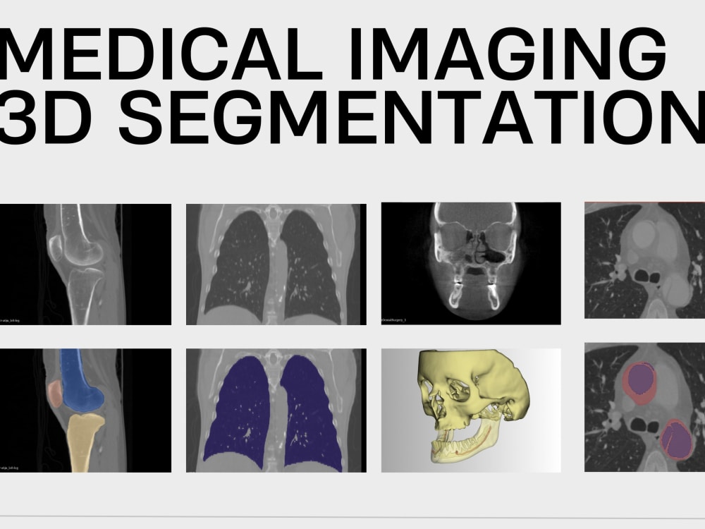 Medical imagining 3D segmentation CT & MRI Scan | Upwork