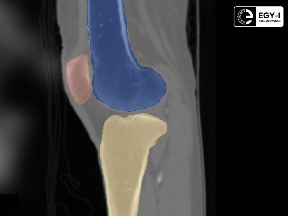 Medical imagining 3D segmentation CT & MRI Scan | Upwork