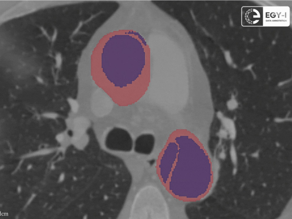 Medical imagining 3D segmentation CT & MRI Scan | Upwork