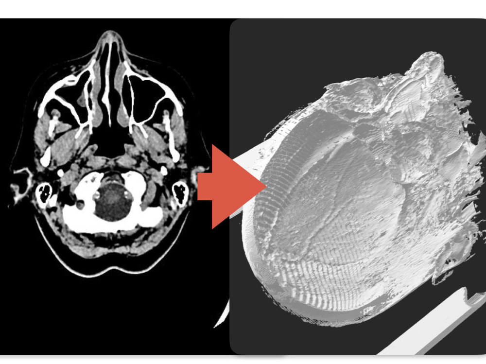 3D Modeling from CT Scan Images Using Marching Cubes Algorithms | Upwork