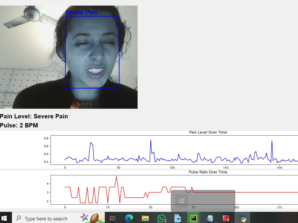 Pain Detection – VGG16, ResNet | Upwork