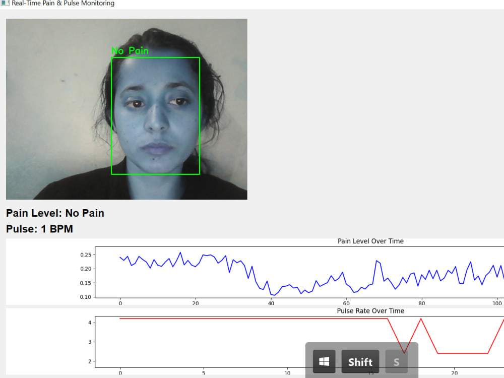 Pain Detection – VGG16, ResNet | Upwork