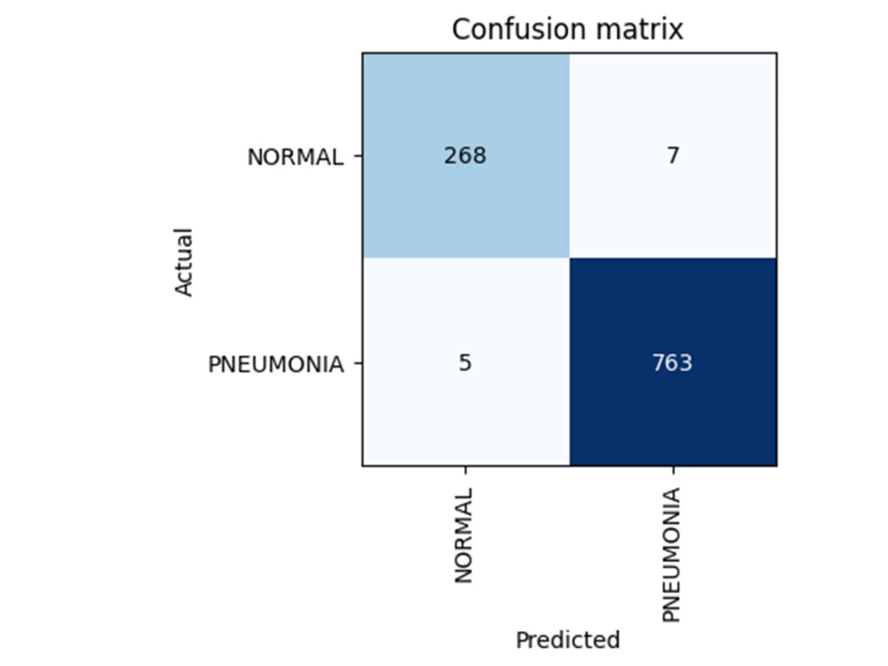 Pneumonia detection model using Fastai | Upwork