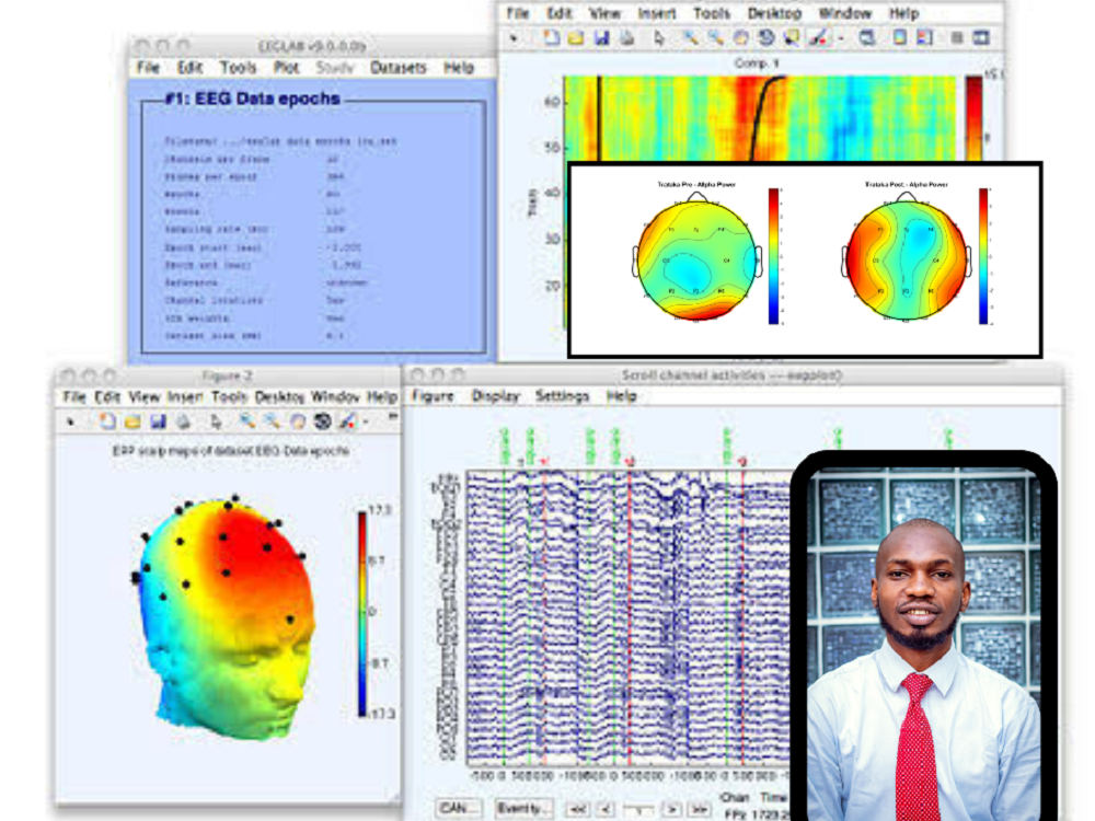 EEG Signal Analysis & Visual Report using MATLAB/EEGLAB | Upwork