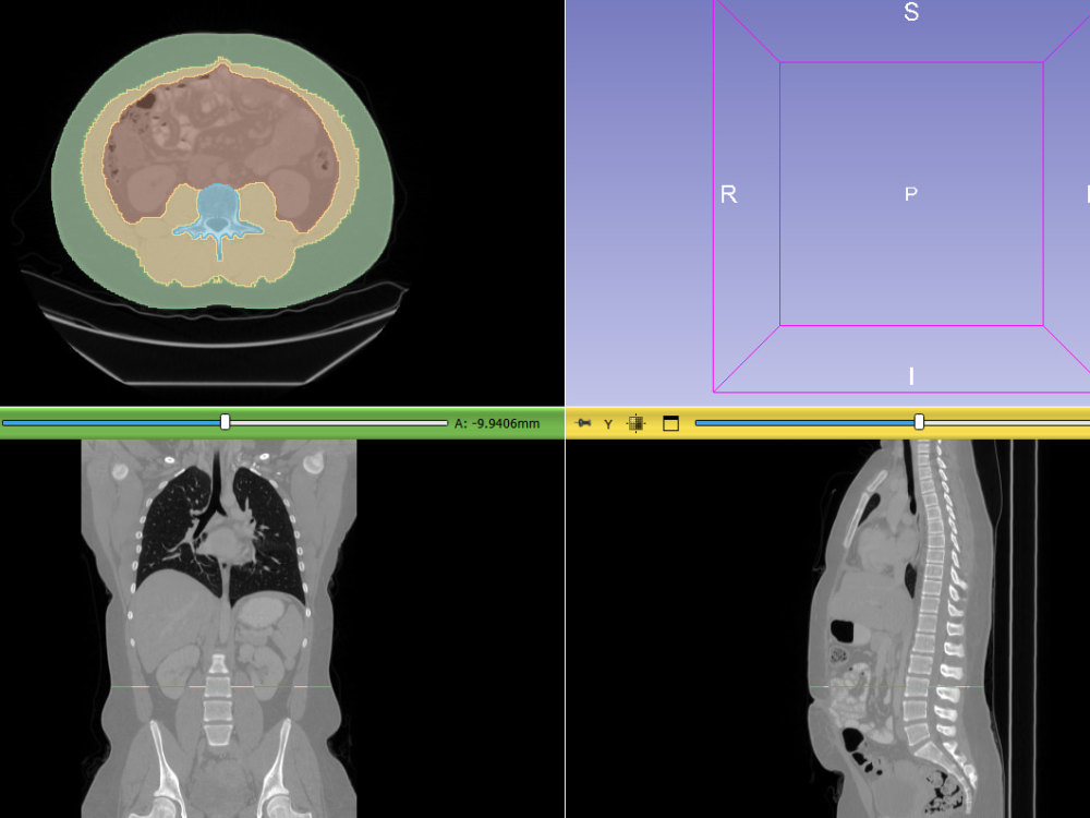 Radiologist for CT, MRI, USG Annotations | DICOM, 3D Slicer, MD.ai | Upwork