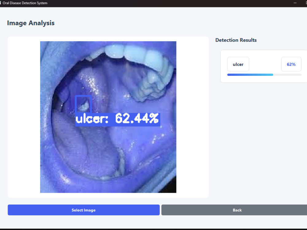 AI-Powered Computer Vision Solutions with YOLO, OpenCV & Deep learning | Upwork
