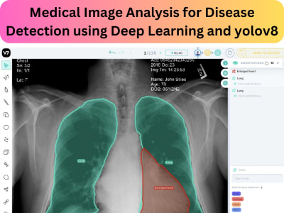 Medical Image Analysis for Disease Detection using Deep Learning and yolov8 | Upwork