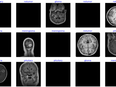 Brain Tumor Detection through Transfer Learning Techniques | Upwork