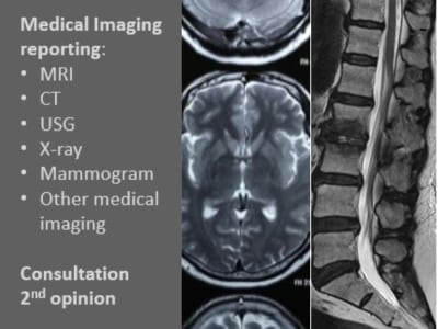 MRI| CT |Xray |USG annotation including AI training, report ...