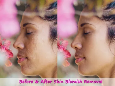 Facial blemish removal service. Edit your photos to perfection! | Upwork