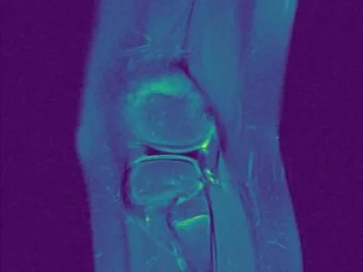 Feature Extraction MRI images deep learning | Upwork
