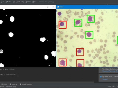 Image Processing and Machine Learning (CNN) projects using Python | Upwork