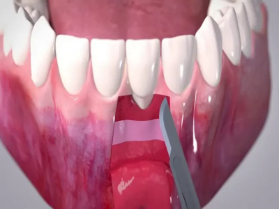 Get a professional 3d medical animation video, dental animation, | Upwork