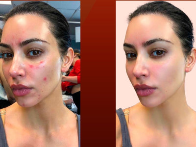 Subtle skin smoothing and blemish removal to advanced color correction ...