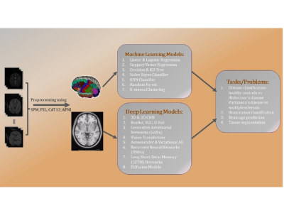 Robust AI/ML/DL models for accurate brain MRI analysis. | Upwork