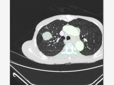 X-ray, CT-scan or mammography Annotation for your AI models | Upwork