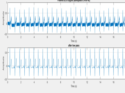 Pre-signal processing package for ECG | Upwork