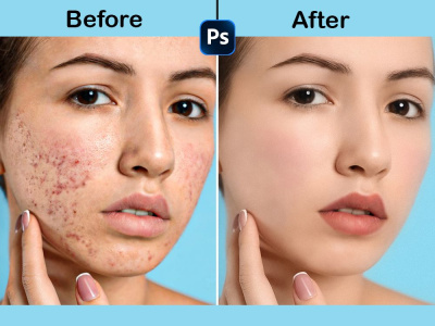 High-End Skin Retouching, Acne Spot Removal & Face Enhancement Services ...