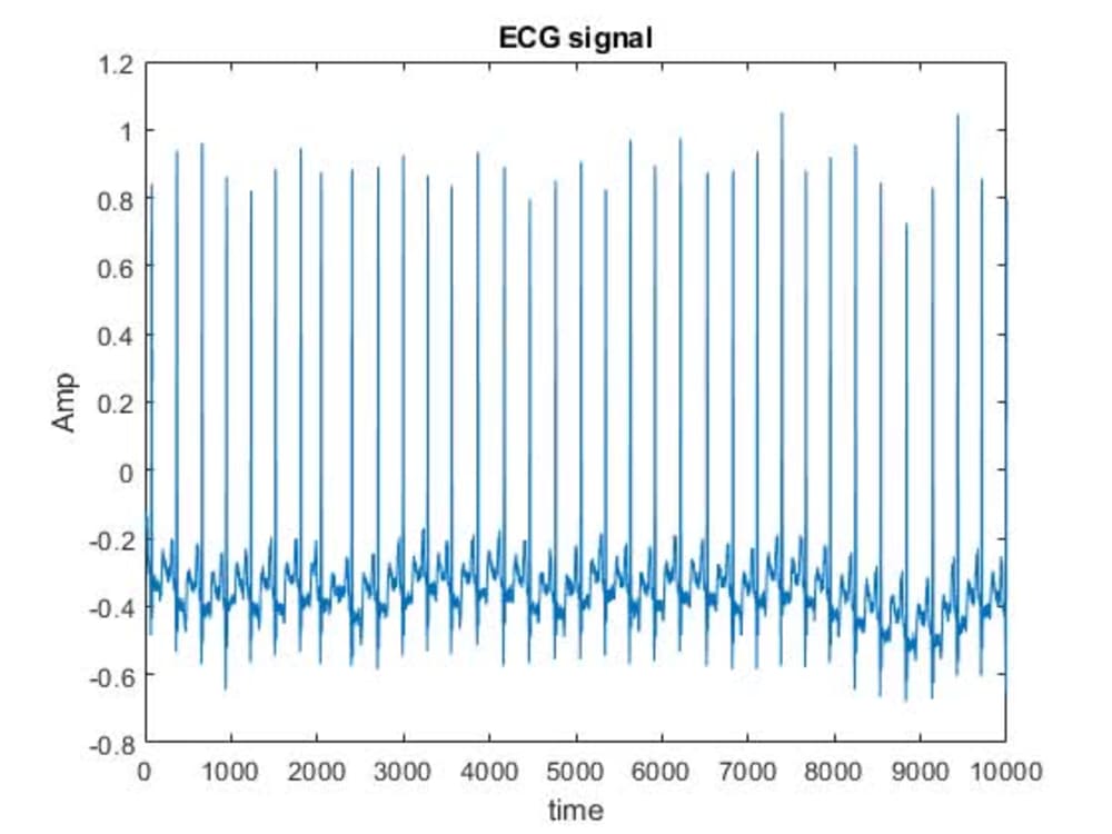 MATLAB based Digital Signal Processing Project | Upwork MATLAB based Digital Signal Processing Project | Upwork