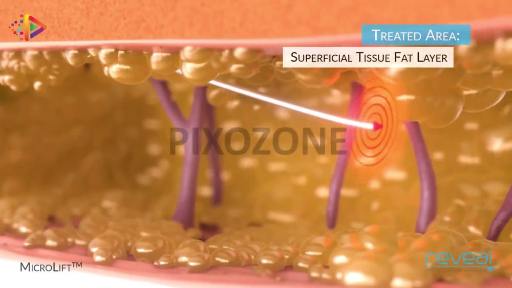 High quality Medical Animation and Biomedical Visualization | Upwork